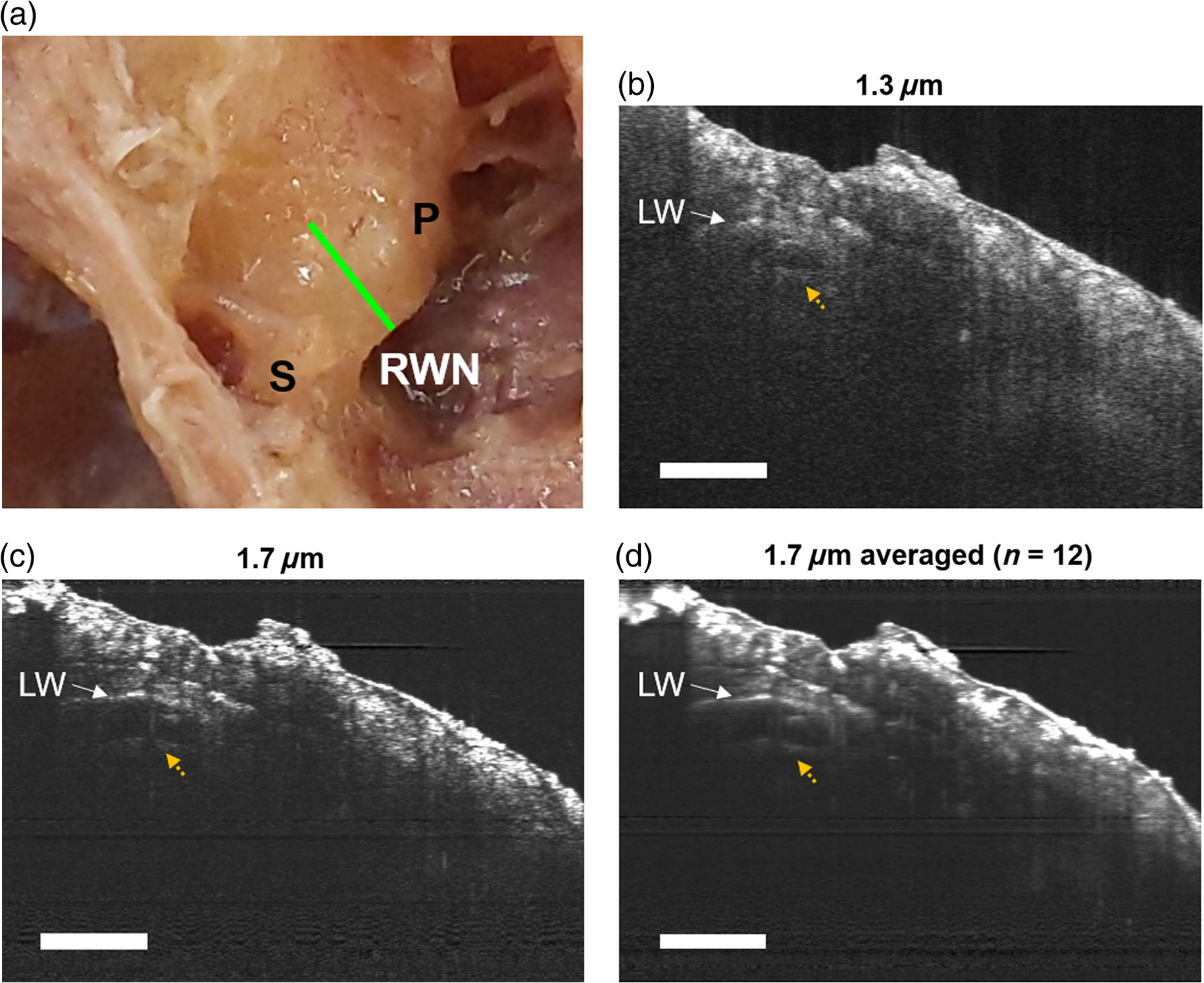 Imaging the ex-vivo human cochlea using 1.3-μm and 1.7-μm optical ...